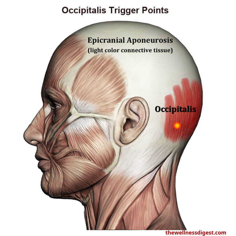Occipitalis Muscle Pain - The Wellness Digest