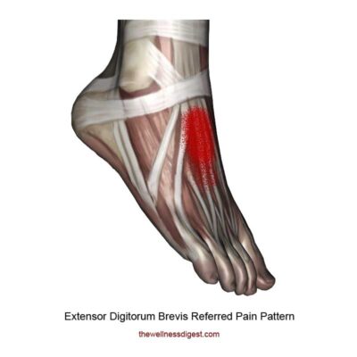Extensor Digitorum Brevis Muscle: Pain In The Top Of The Foot - The ...