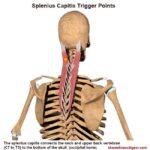 Splenius Capitis Muscle: Pain At The Top Of The Head - The Wellness Digest
