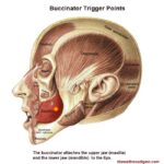 Buccinator Muscle: Cheek, Mouth Teeth Pain – The Wellness Digest