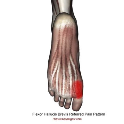 Flexor Hallucis Brevis Muscle: Foot and Big Toe Pain - The Wellness Digest