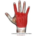 Lumbrical Muscles of Hand: Hand and Finger Pain - The Wellness Digest