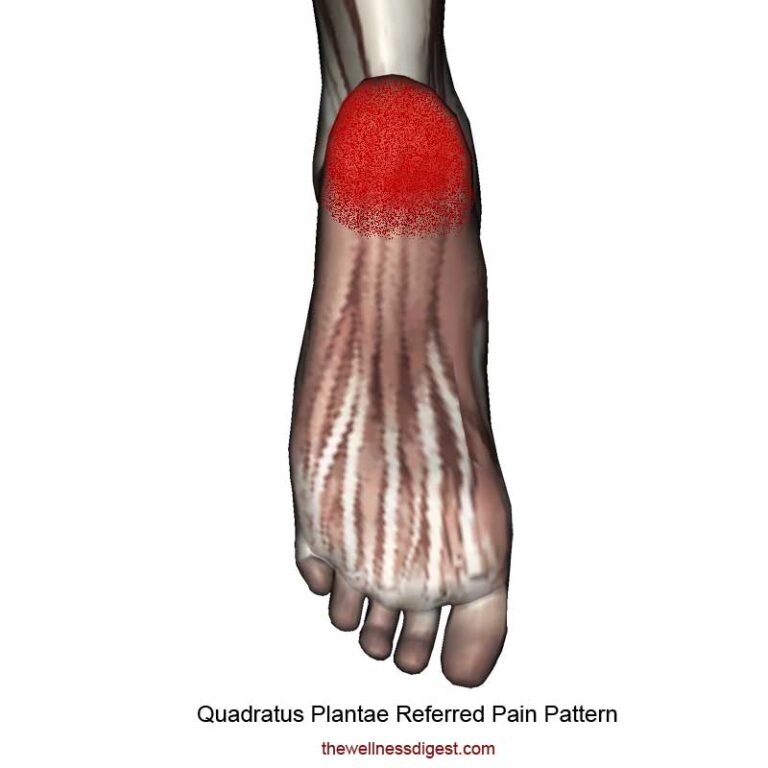 Quadratus Plantae Muscle: Heel Pain - The Wellness Digest