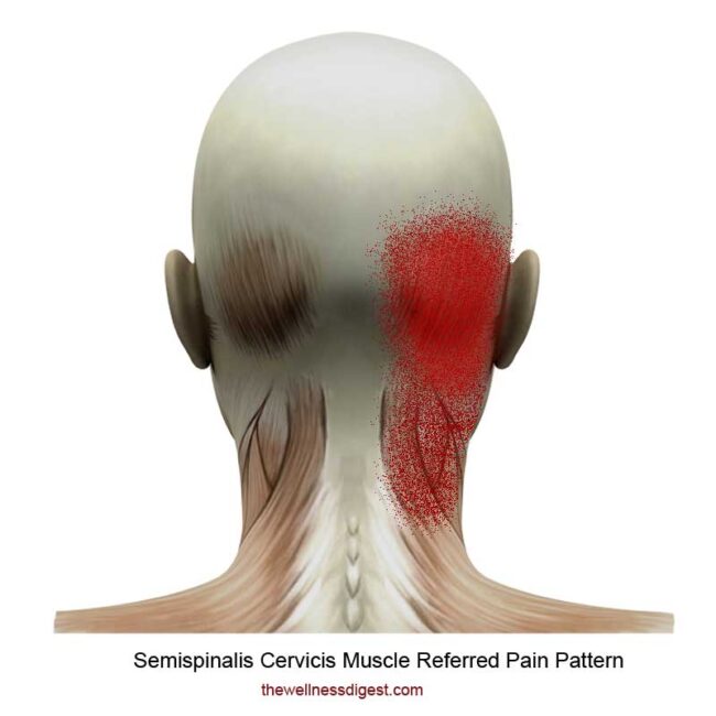 Semispinalis Cervicis Muscle: Head and Neck Pain - The Wellness Digest