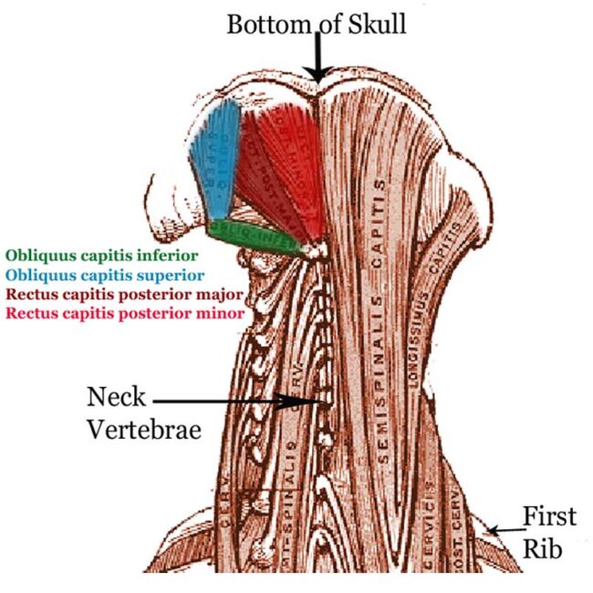 Suboccipital Anatomy: Rectus Capitis Posterior Major and Minor ...