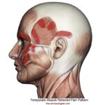 Temporalis Muscle: Origin, Insertion, Action, Innervation - The ...