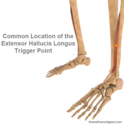 Extensor Hallucis Longus Muscle: Big Toe and Foot Pain - The Wellness ...