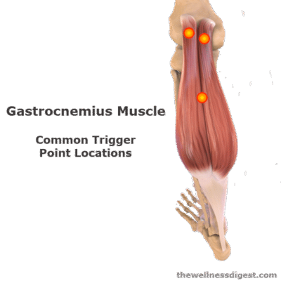 Gastrocnemius Muscle: Knee and Foot Pain - The Wellness Digest