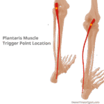 Plantaris Muscle: Back Of The Knee Pain - The Wellness Digest