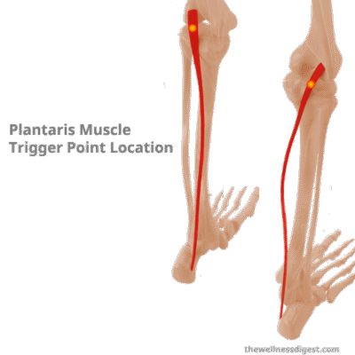 Plantaris Muscle: Back Of The Knee Pain - The Wellness Digest