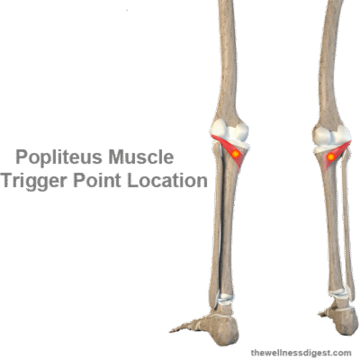 Popliteus Muscle: Pain And Stiffness Behind The Knee – The Wellness Digest