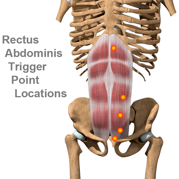 Rectus Abdominis: Abdominal Pain - The Wellness Digest