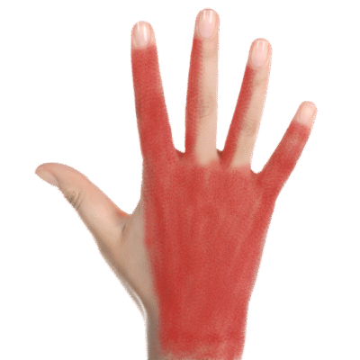 Lumbrical Muscles Of The Hand: Hand And Finger Pain – The Wellness Digest