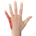 Lumbrical Muscles Of The Hand: Hand And Finger Pain – The Wellness Digest