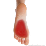 Adductor Hallucis Muscle: Foot Pain – The Wellness Digest