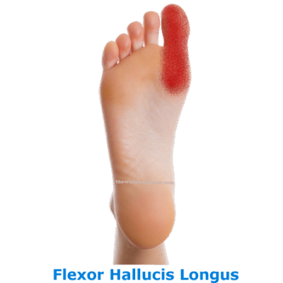 Flexor Hallucis Brevis Muscle: Foot And Big Toe Pain - The Wellness Digest